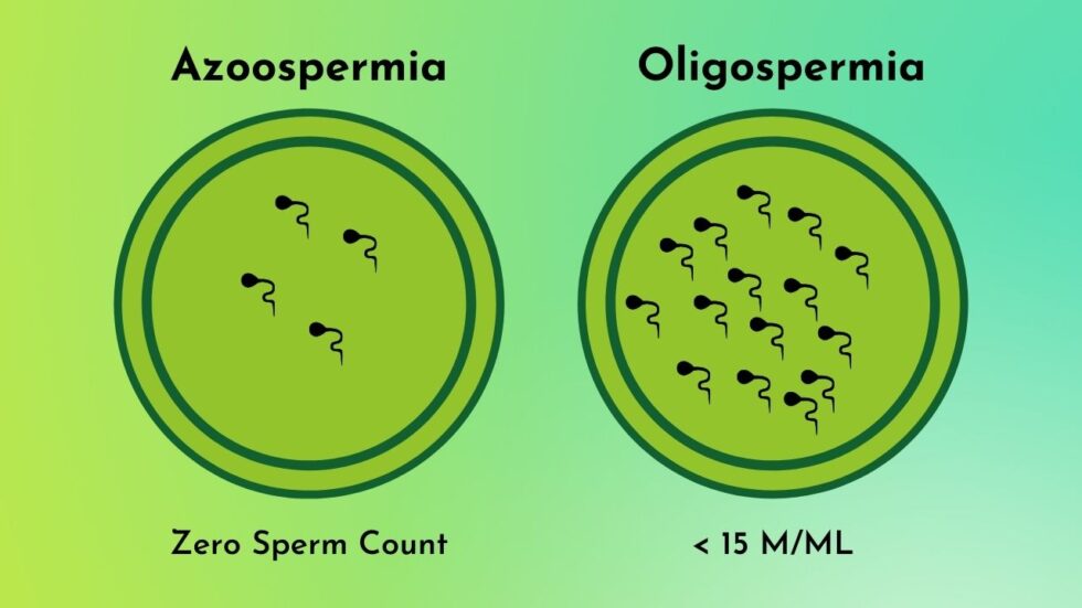 A Comprehensive Guide About Azoospermia and Oligospermia | ONP Hospitals