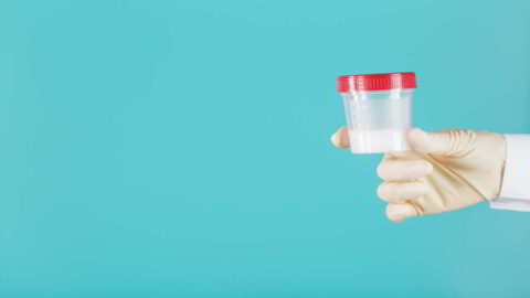 Semen Analysis | Sperm Analysis | CASA | ONP Hospitals